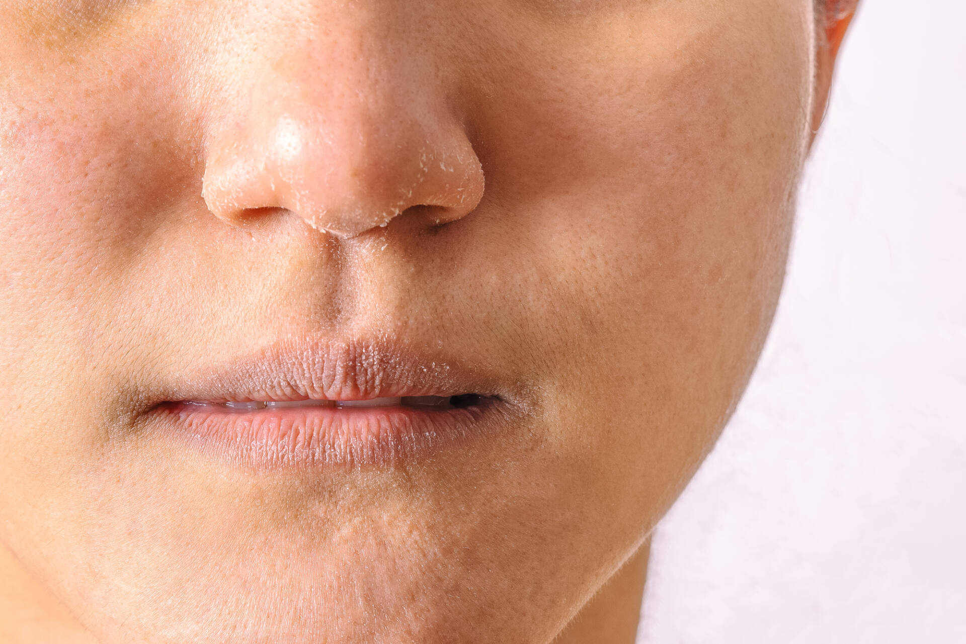 When I Rub My Skin It Rolls Off? Reasons Your Skin Is Rolling Off!